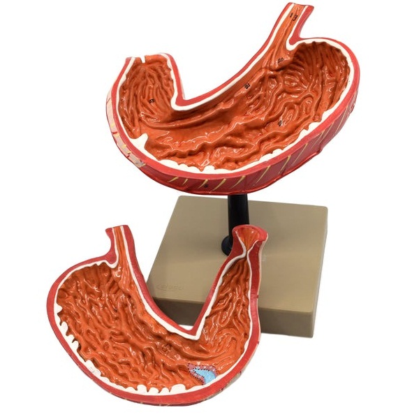 Eisco Human Stomach Model, 2 Parts, Three Dimensional, View with Hand ...