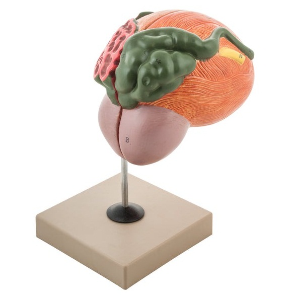 Eisco Labs Human Urinary Bladder with Prostate Anatomical Model, 2 ...