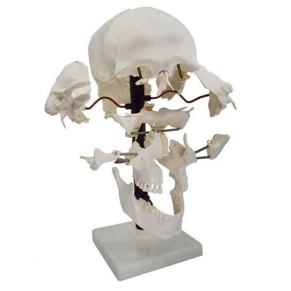 Eisco Beauchene Exploded Skull Model - 13 Parts - Life Size - Mounted ...