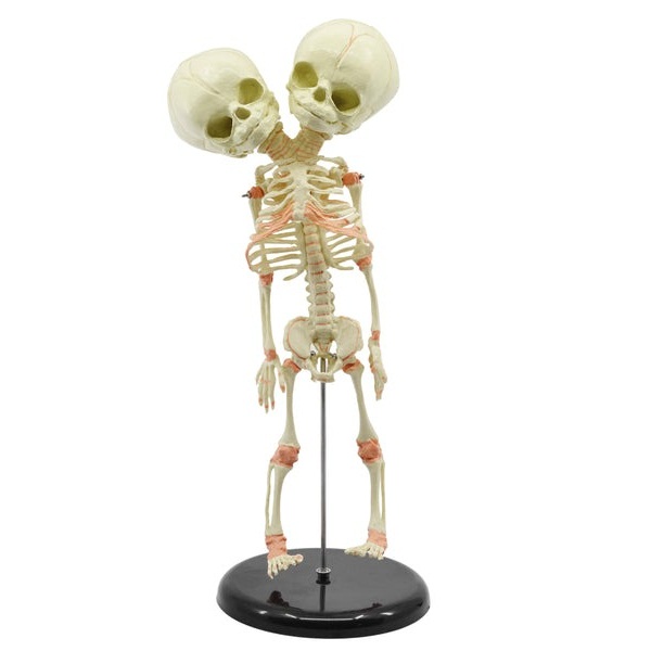 Eisco Infant Fetus Skeleton Model, Mini Size - Twin, Conjoined Skull ...